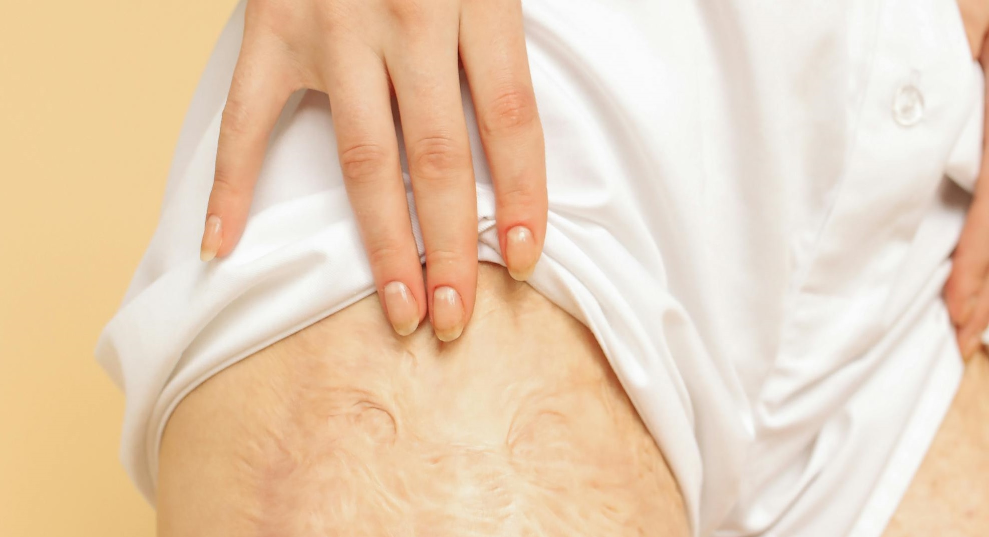 Cellulite e Palestra: Come Eliminare la Cellulite con l'Esercizio Fisico