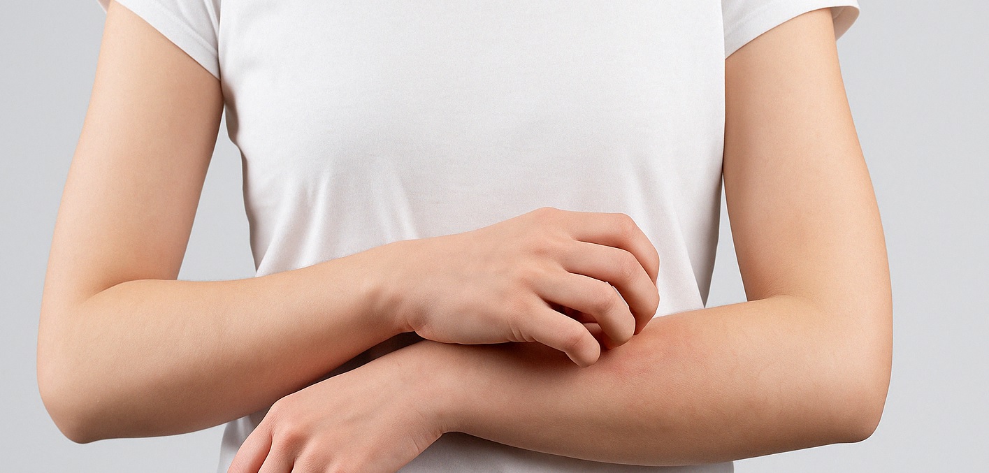 Come Riconoscere la Scabbia: Sintomi e Test da Fare